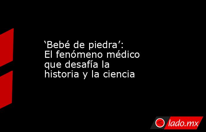 ‘Bebé de piedra’: El fenómeno médico que desafía la historia y la ...
