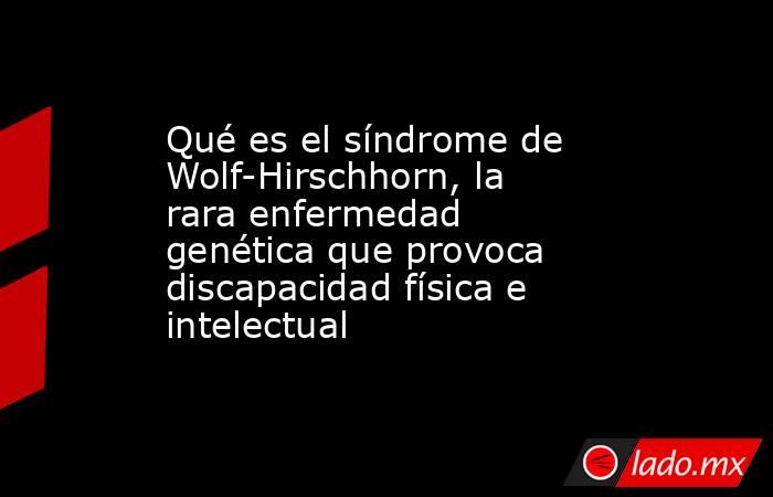 Qué es el síndrome de Wolf-Hirschhorn, la rara enfermedad genética que ...